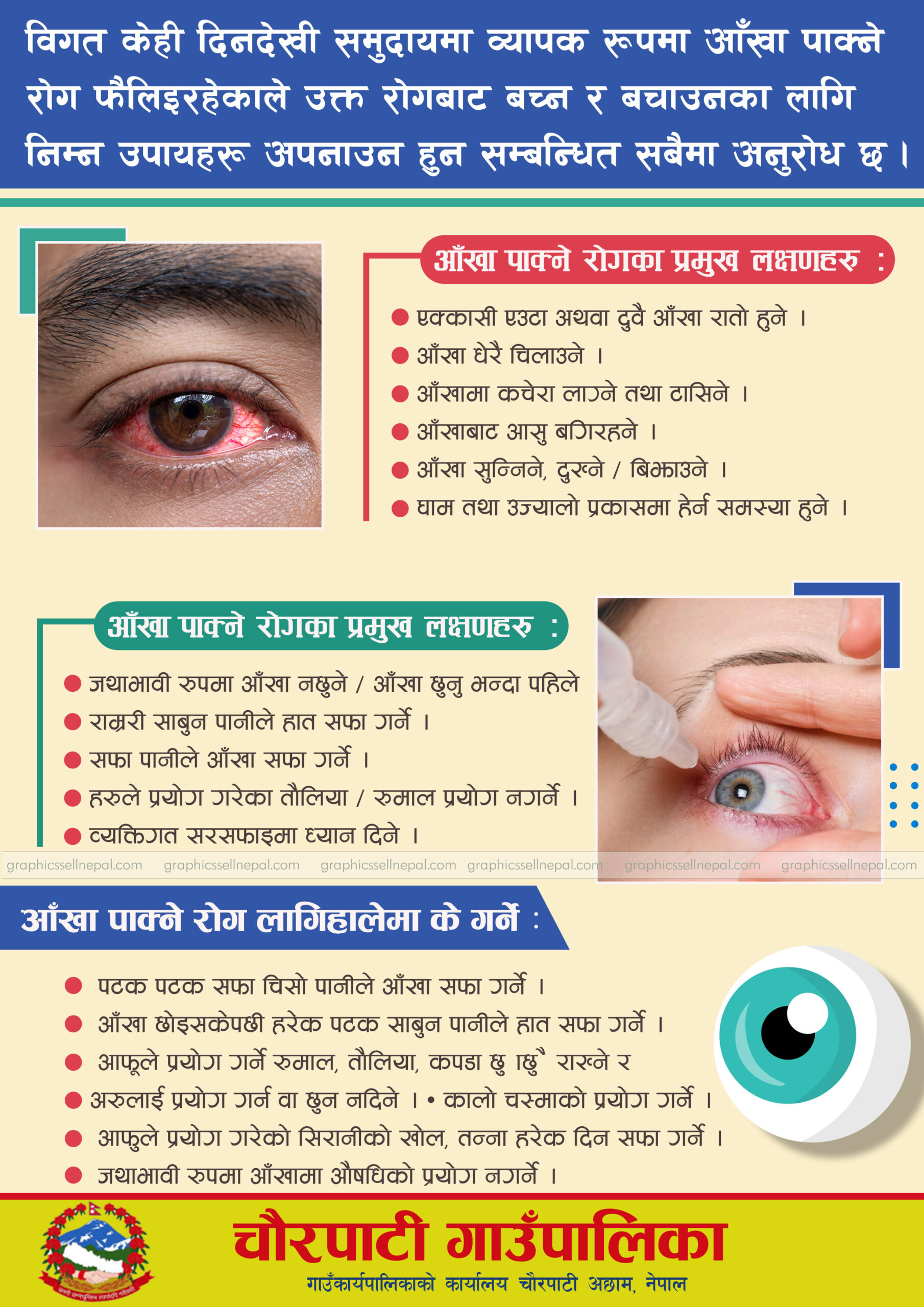 FN : 16035 Eye Flu Awareness Flex – Graphic Sell Nepal